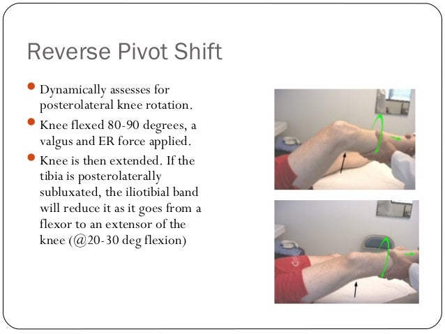 Lateral Pivot Shift Test Knee