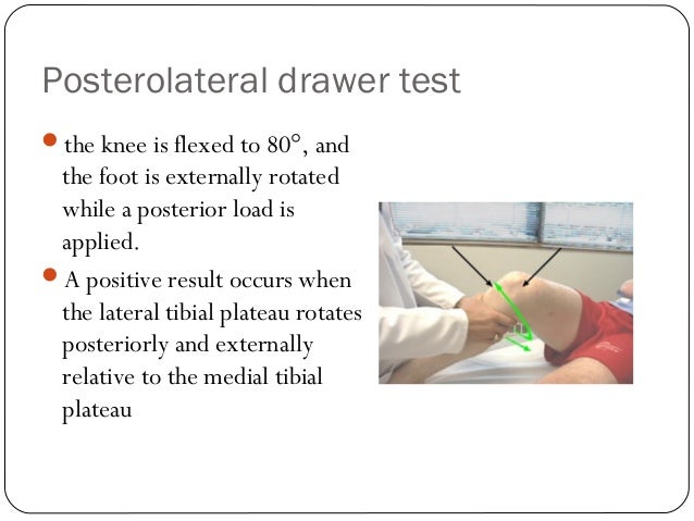 Posterolateral corner injuries of knee joint
