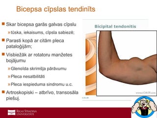 Pleca locītavas artroskopija | PPT