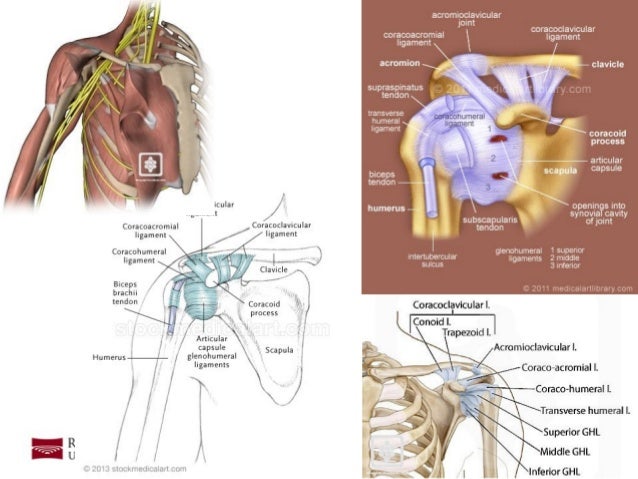 Pleca locītavas nestabilitāte