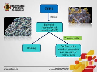 Protein ZEB1 and resistance to radiation therapy, and antibodies to damage lungs | PPT