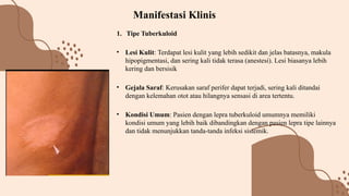 "Analisis Kasus Lepra pada Pasien dengan Gejala Baal dan Manifestasi ...