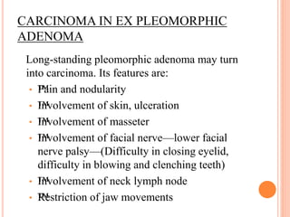 PLEOMORPHIC ADENOMA presentaion sss.pptx