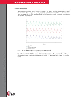 Plethysmographic waveform | PDF | Digital Audio | Computer Software and ...