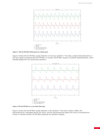 Plethysmographic waveform | PDF | Digital Audio | Computer Software and ...