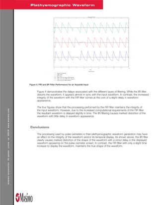 Plethysmographic waveform | PDF | Digital Audio | Computer Software and ...