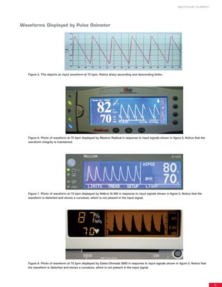 Plethysmographic waveform | PDF | Digital Audio | Computer Software and ...