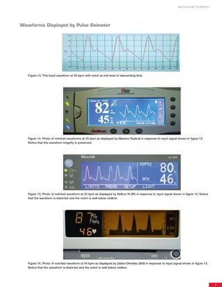 Plethysmographic waveform | PDF | Digital Audio | Computer Software and ...