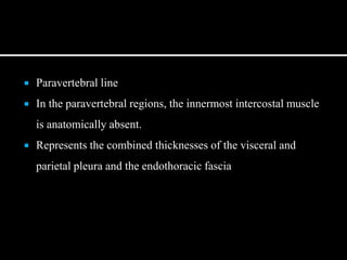 Pleura Diseases | PPTX