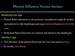 Pleura Diseases | PPTX