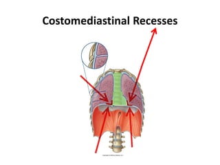 Costomediastinal Recess