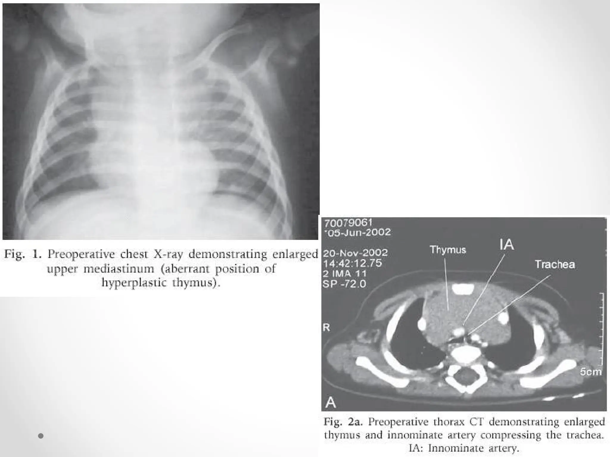 Pleurae, Trachea & Principal Bronchi By Dr Rabia Inam Gandapore.pptx