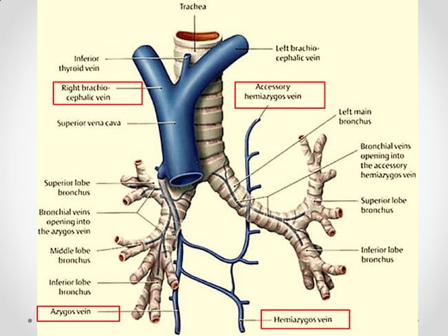 Pleurae, Trachea & Principal Bronchi By Dr Rabia Inam Gandapore.pptx