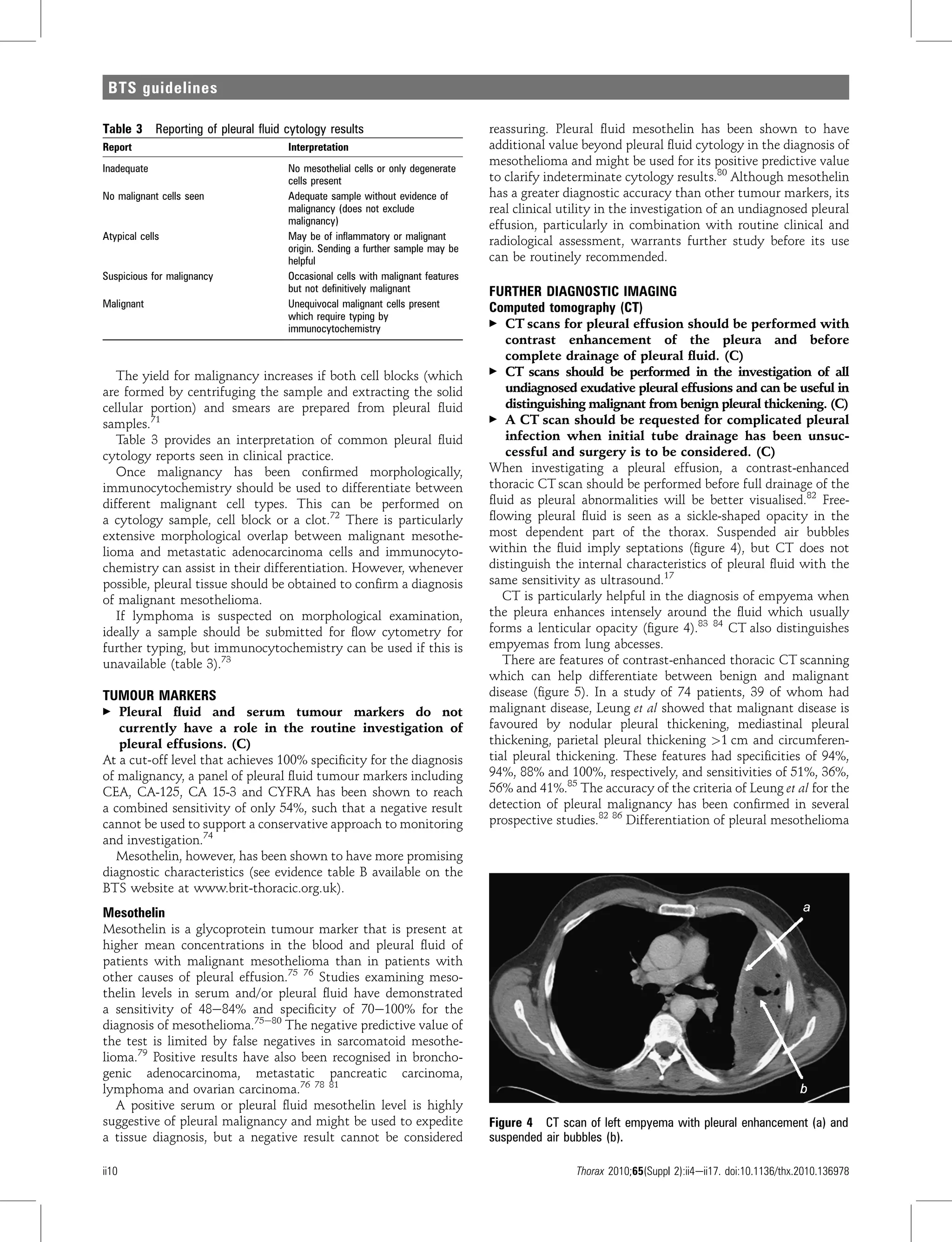 Pleural disease 2010 investigation | PDF