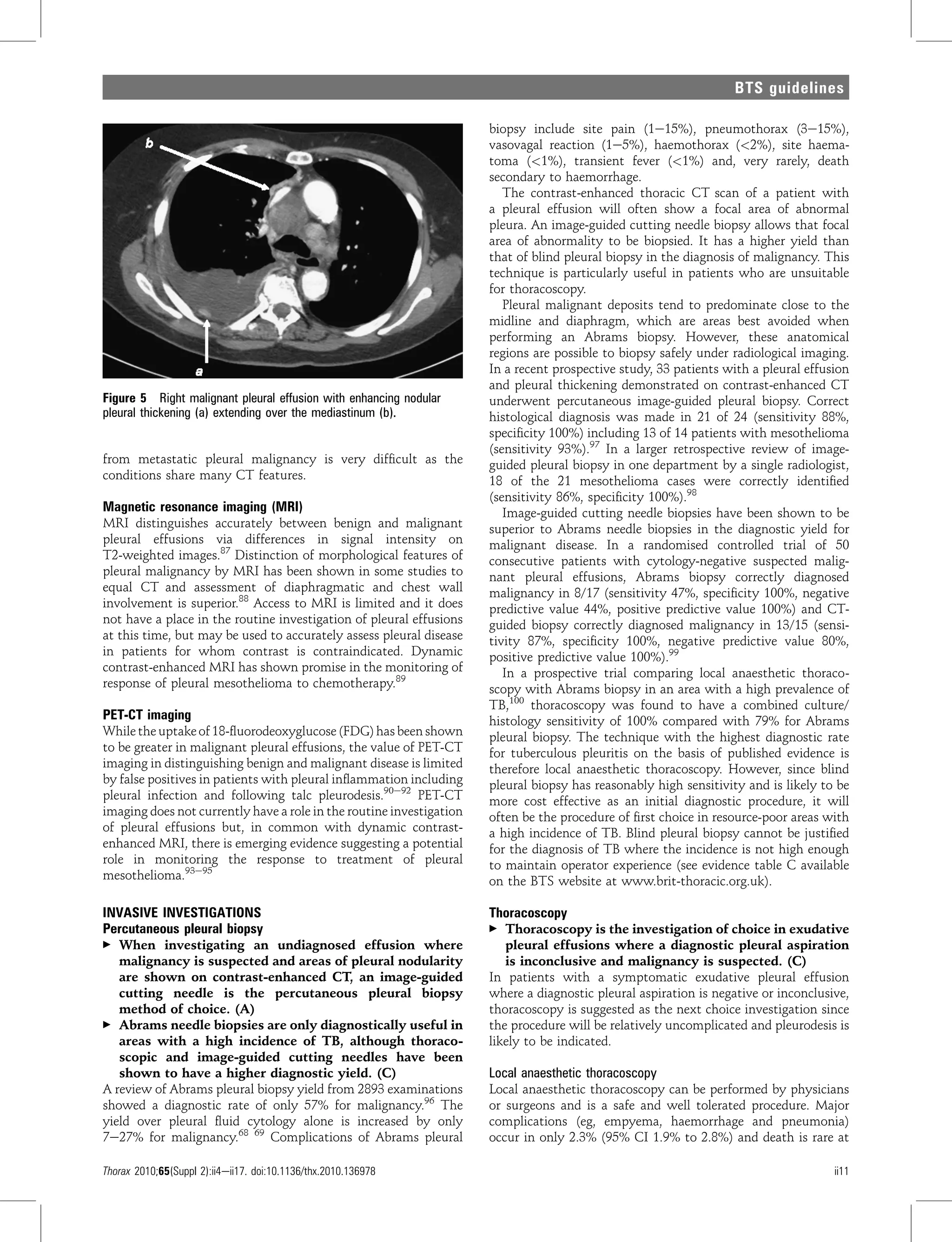 Pleural disease 2010 investigation | PDF