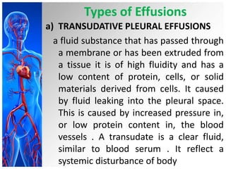 Pleural Effusion | PPTX
