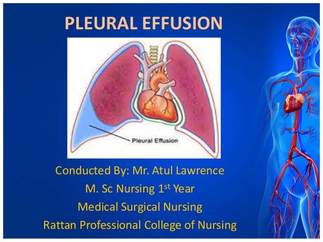 Pleural Effusion Pleural Effusion Medical Surgical Nursing Nursing Porn Sex Picture