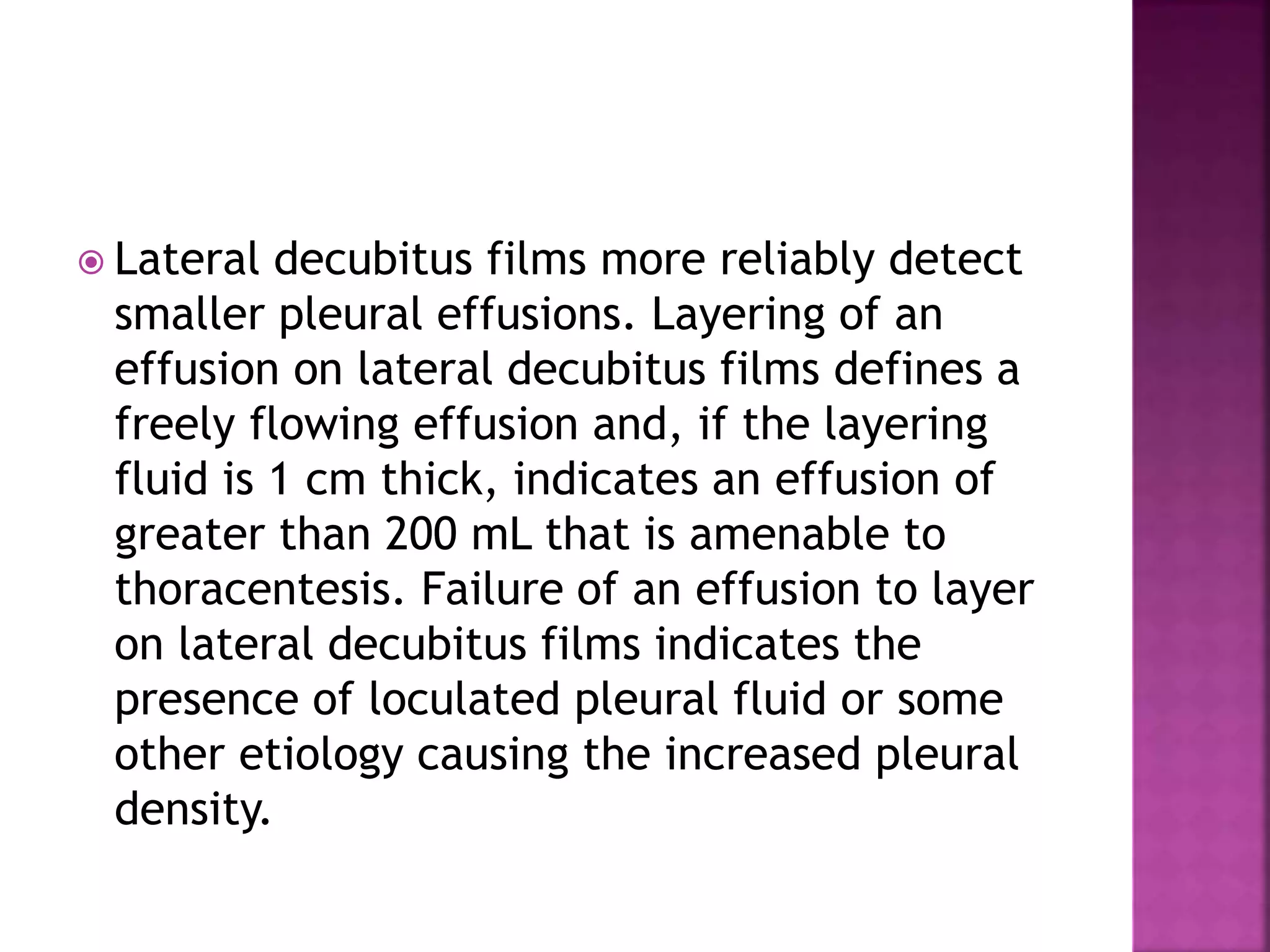 Pleural effusion | PPTX