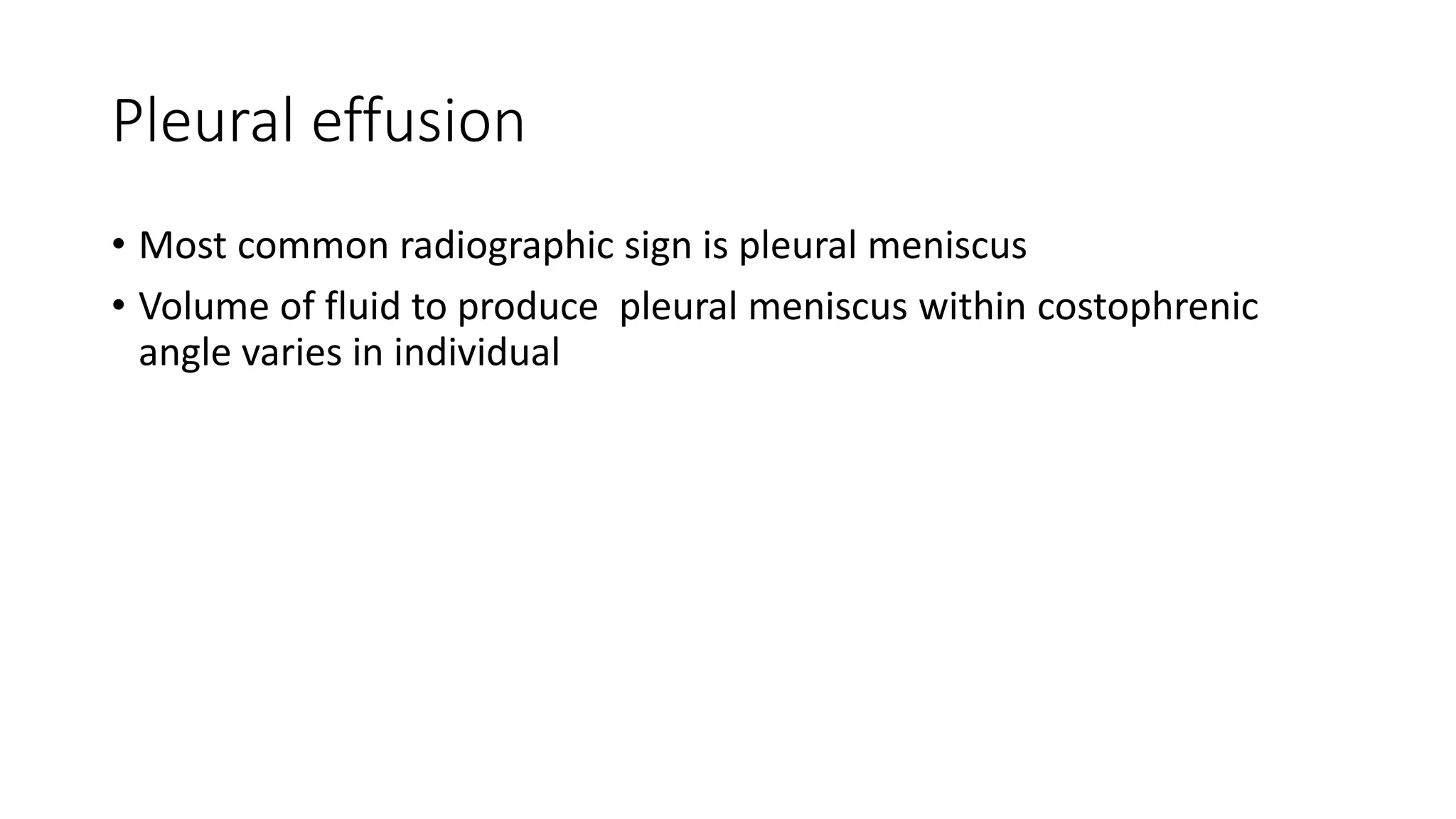 Pleural effusion(X-ray Findings) | PDF