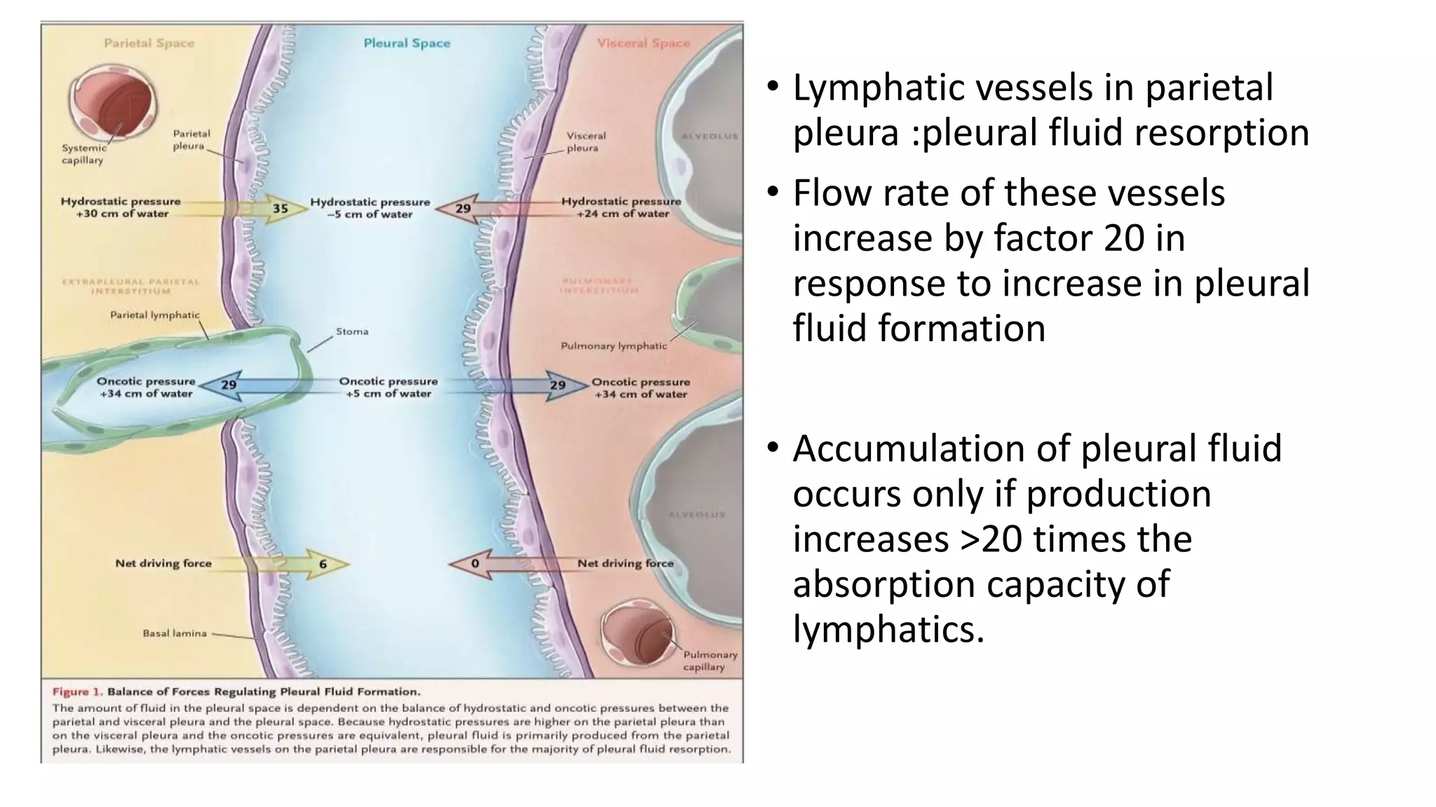 Pleural effusion in children | PPTX