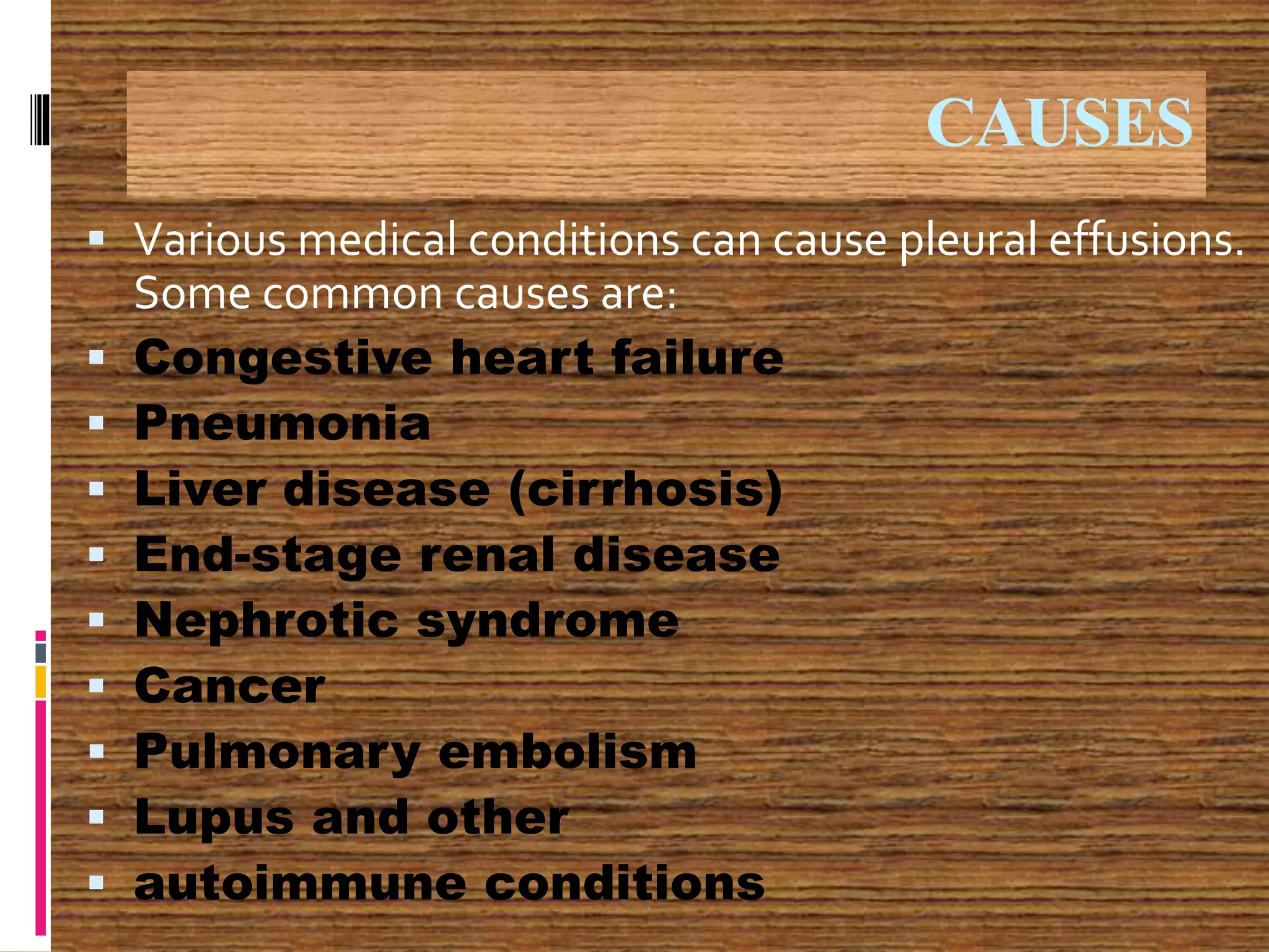 Pleural effusion | PPTX