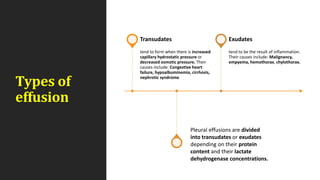 Pleural effusion | PPT
