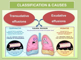PLEURAL EFFUSION.pptx