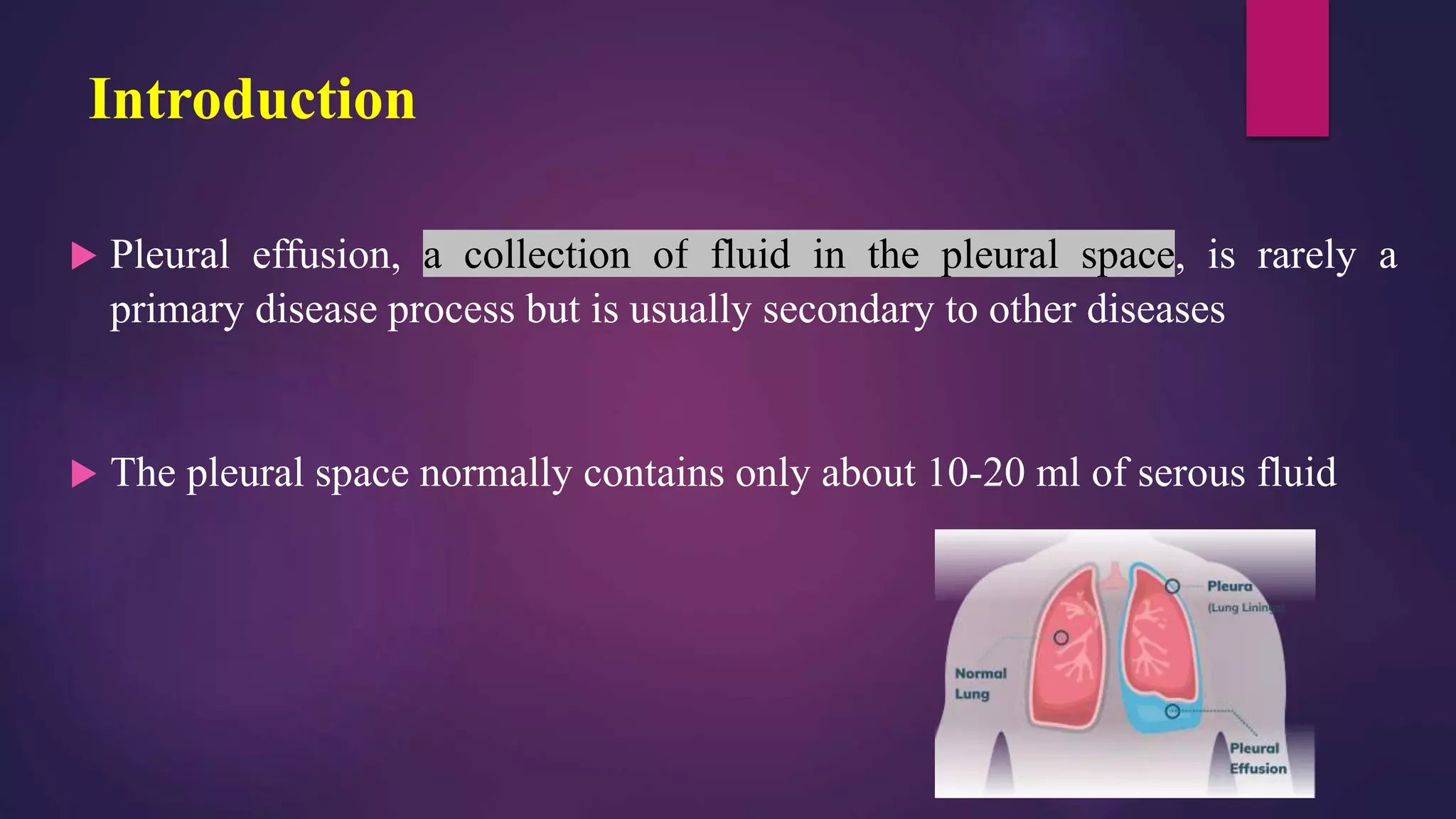 pleural effusion.pptx
