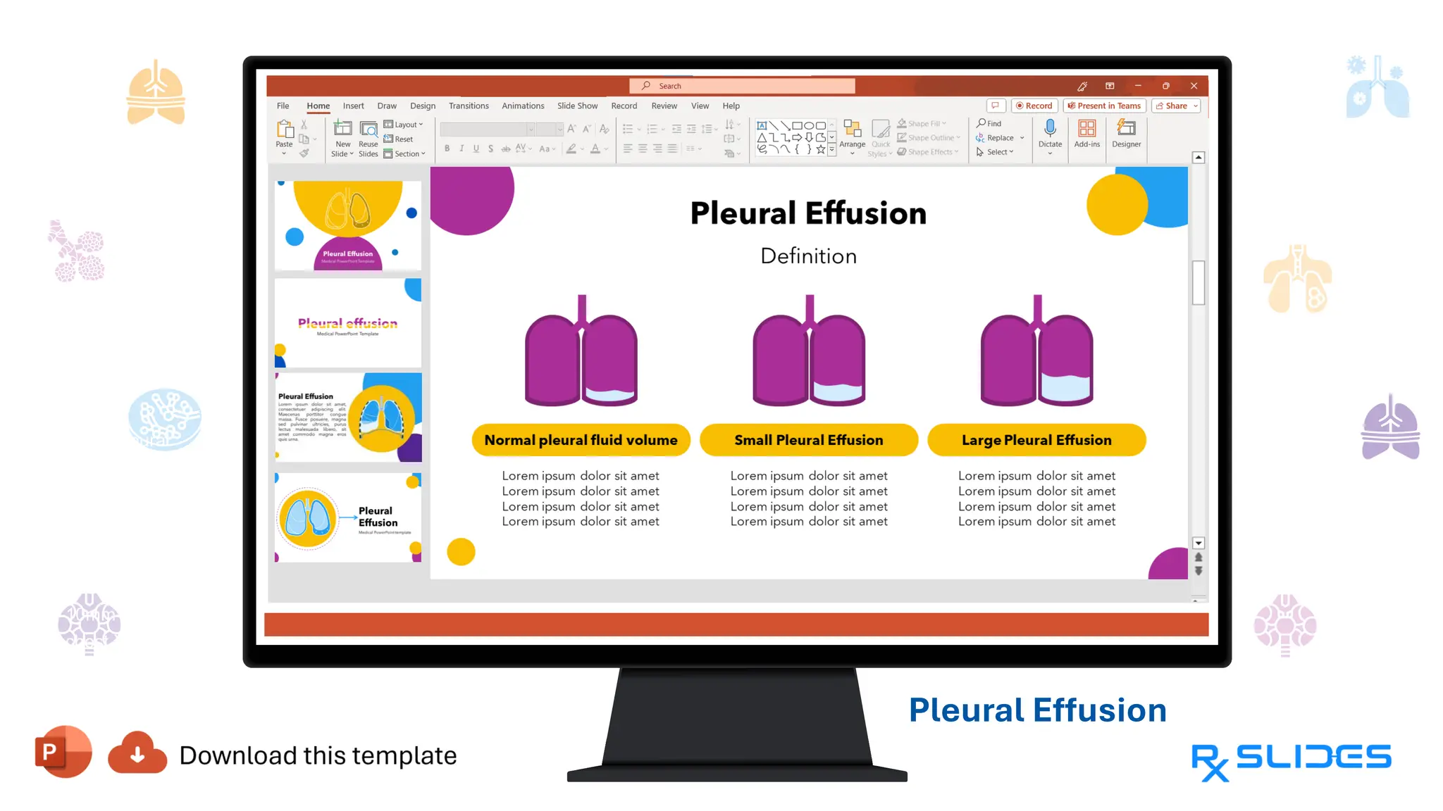 pleural effusion | PDF