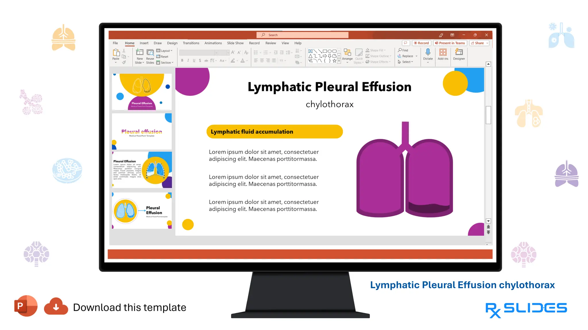 pleural effusion | PDF