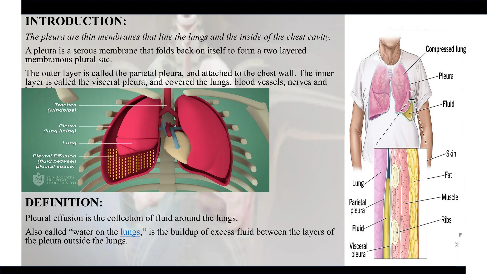 PLEURAL EFFUSION, TYPES AND MANAGEMENT.pdf