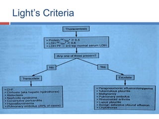 Pleural effusion , deffention diagnosis and treatment | PPT