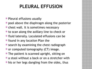 Ultrasound of Pleural effusion and ultrasound finding.pptx