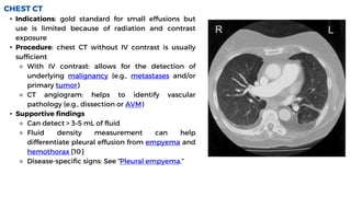 PLEURAL EFFUSION (1).pptx