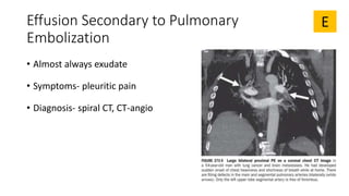 Pleural effusion 18022019 | PPTX