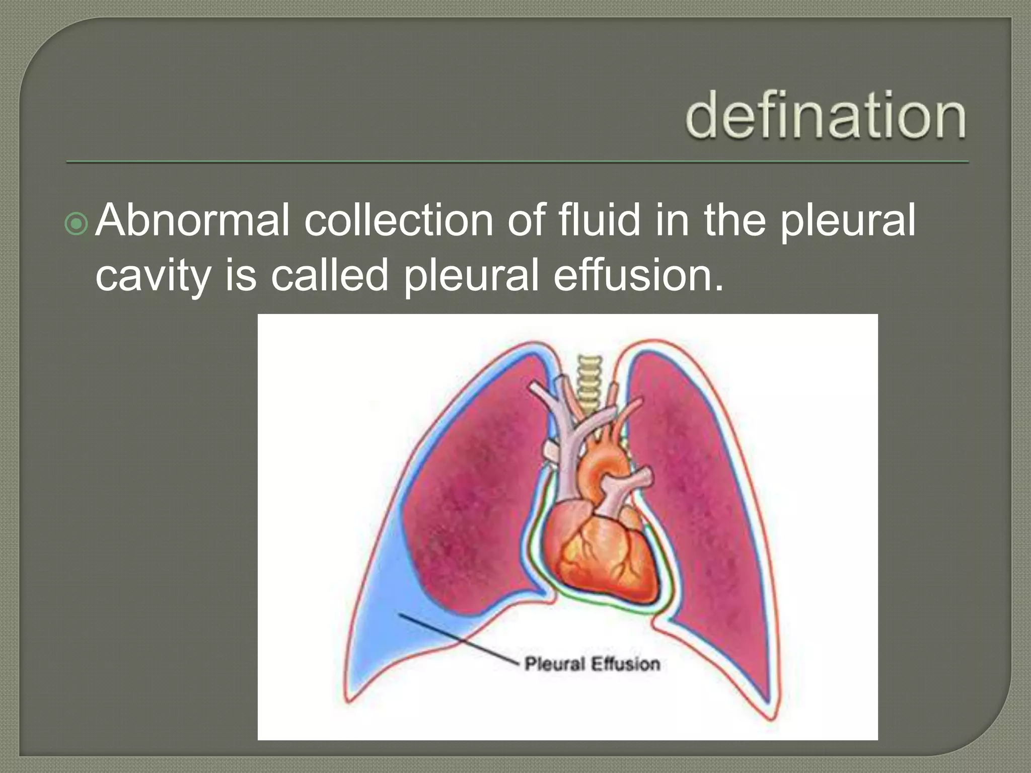 Pleural Effusion by Dr Asad.pptx