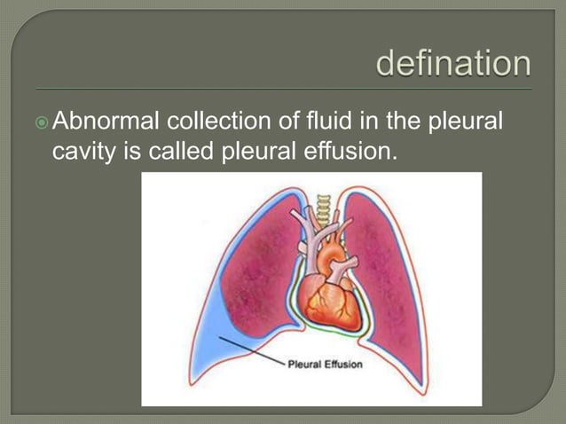 Pleural Effusion by Dr Asad.pptx