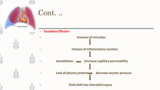Pleural effusion dr.anush | PDF