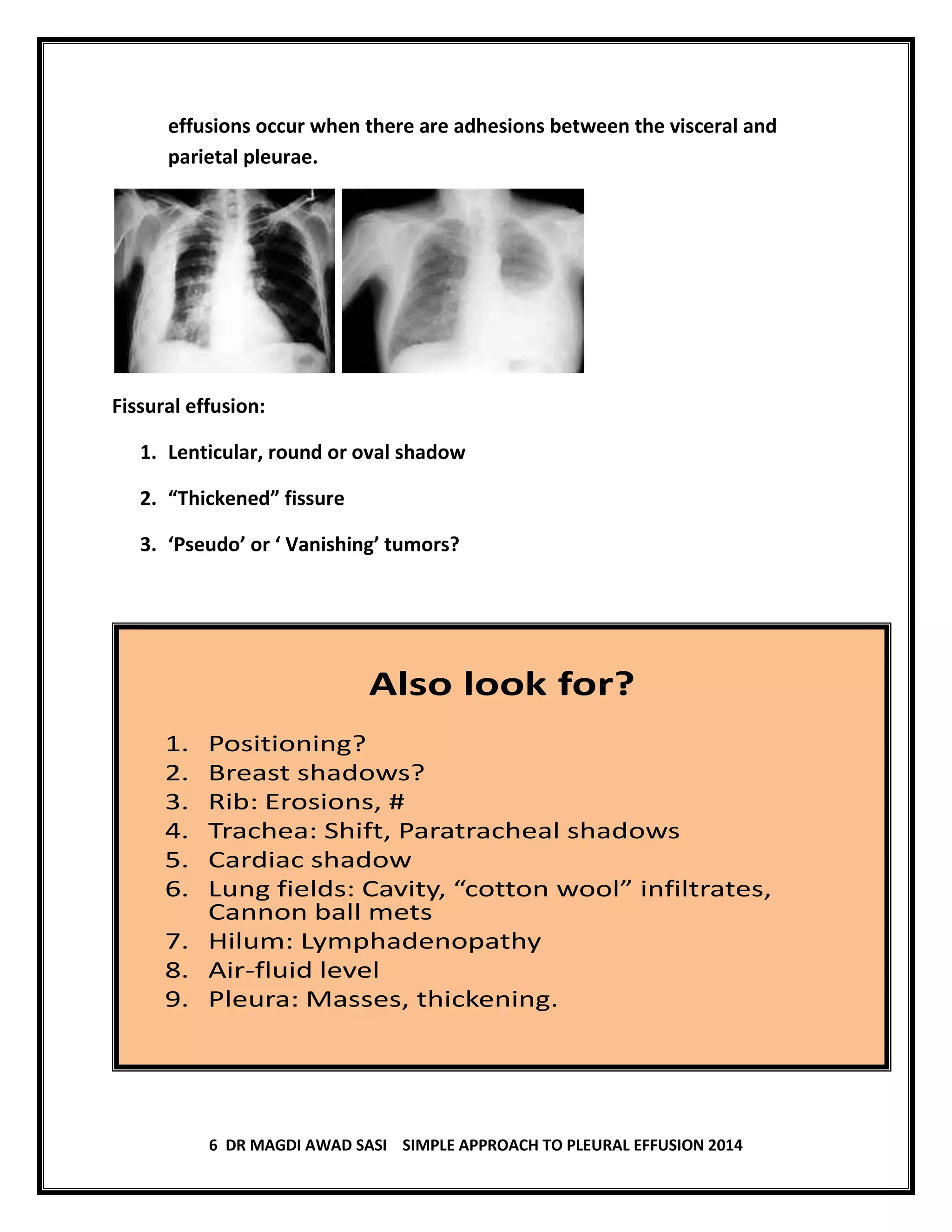 Pleural effusion dr magdi sasi | DOCX