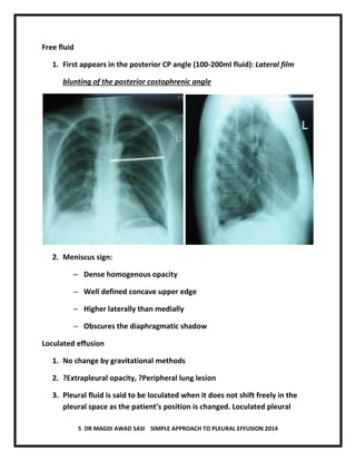 Pleural effusion dr magdi sasi | DOCX