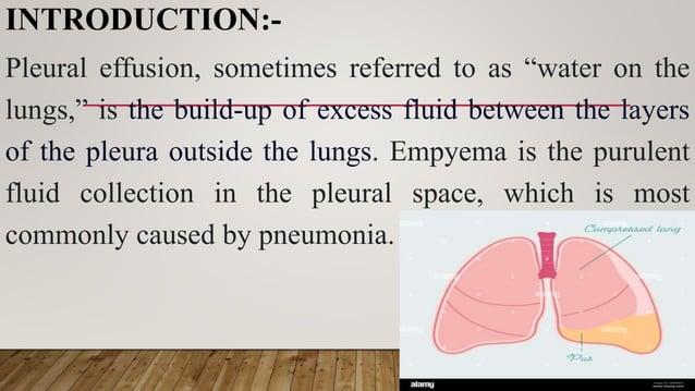 Pleural effusion & empyema.pptx