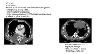 Pleural effusion and pleura final...pptx