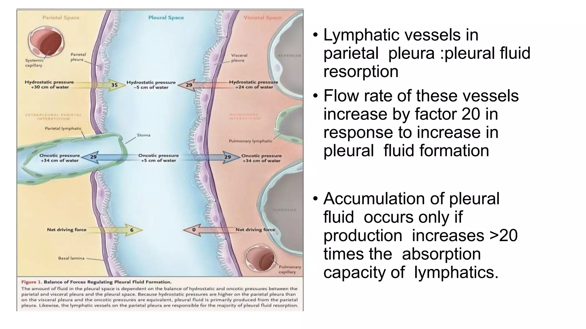 Pleural Effusion in Children-converted.pptx