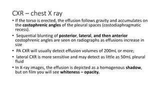 Pleural Effusion lecture | PPTX