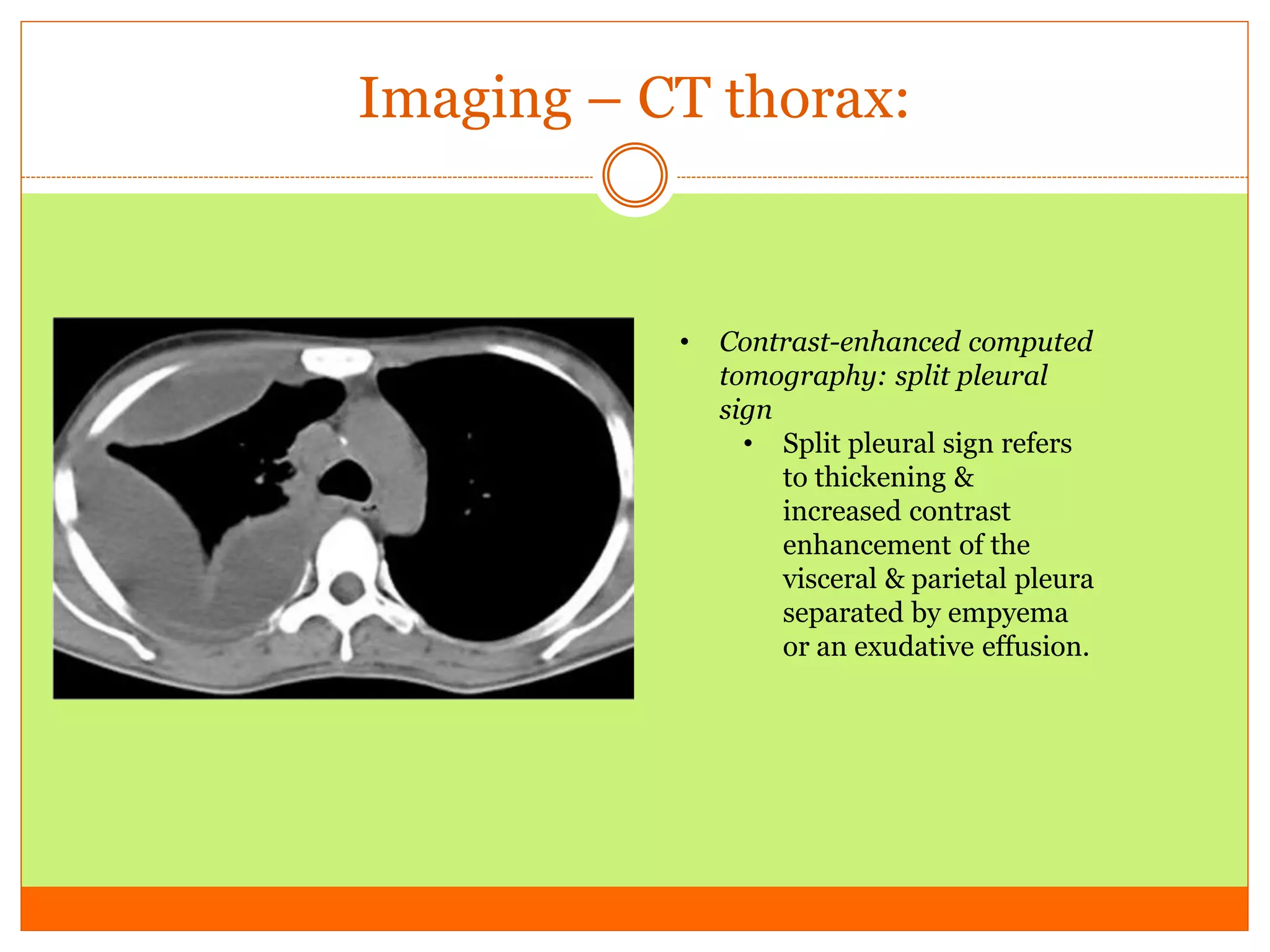 Pleural effusion ppt | PPTX