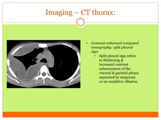 Pleural effusion ppt | PPTX