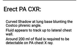 pleural effusion presentation ling disease.pdf