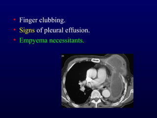 Pleural empyema dr.tinku joseph | PPT