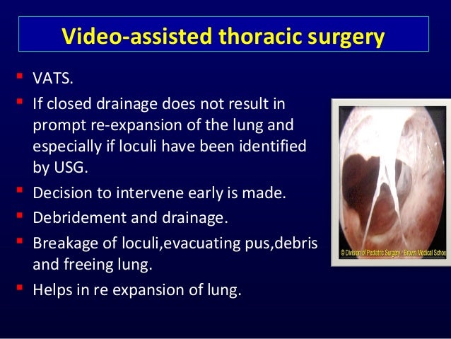 Pleural empyema dr.tinku joseph