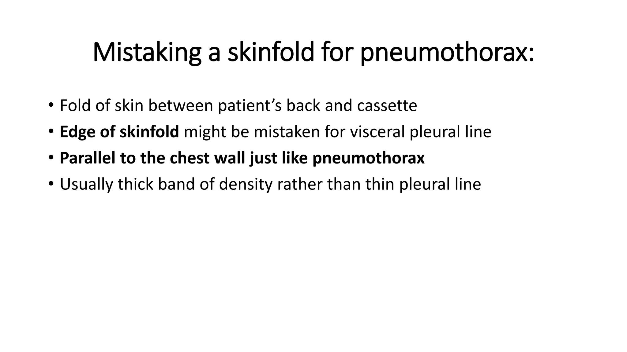 Pleural Effusion & Pneumothorax radiology made simple by Anish Dhakal ...